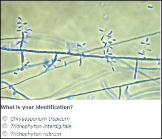 Dermatophyte : trichophyton | Medik Bloglist