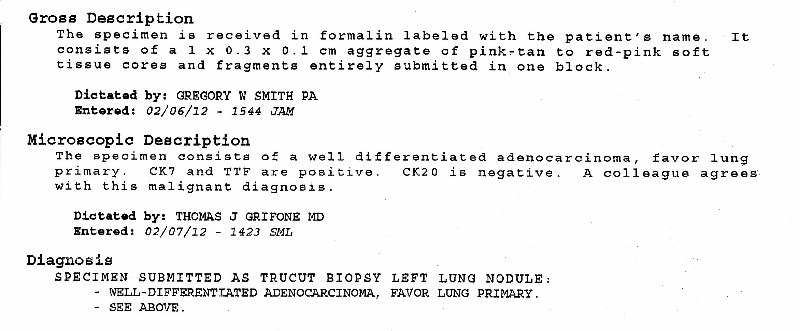 my lung cancer odyssey: you have lung cancer
