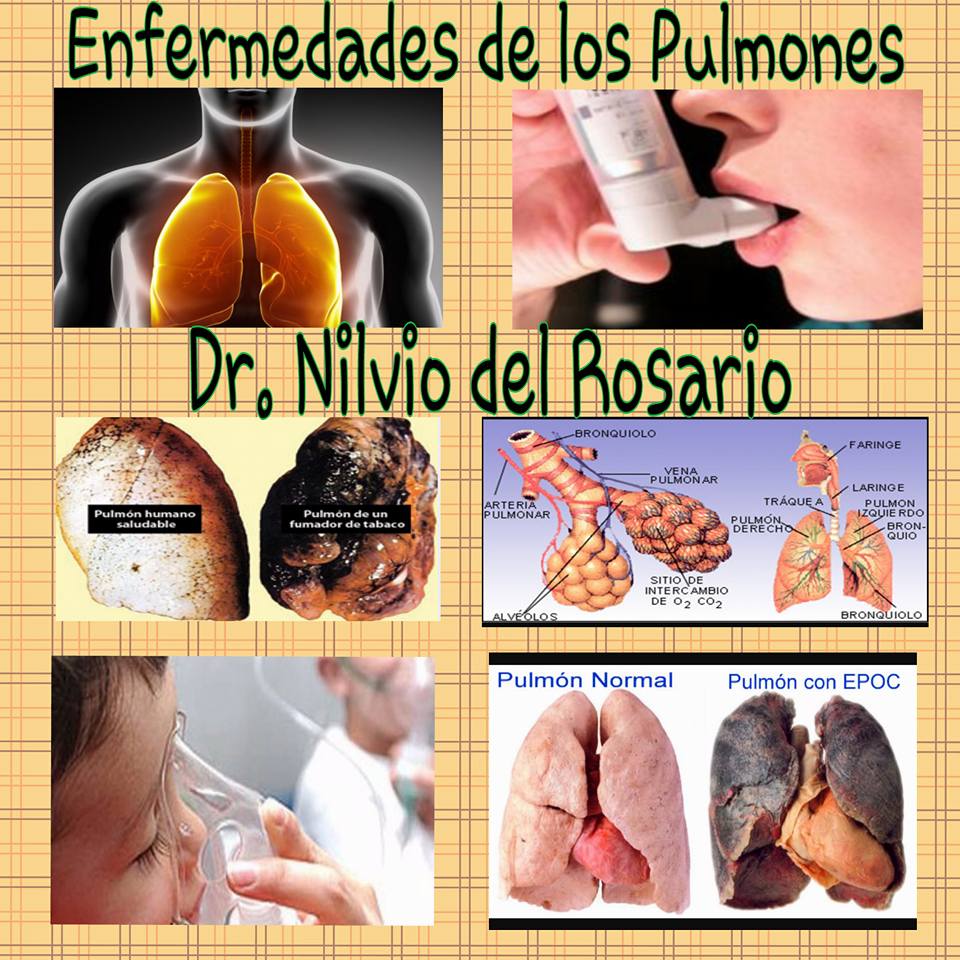 Belleza y Salud con Paty Ayala: Las Enfermedades Pulmonares, Causas y ...