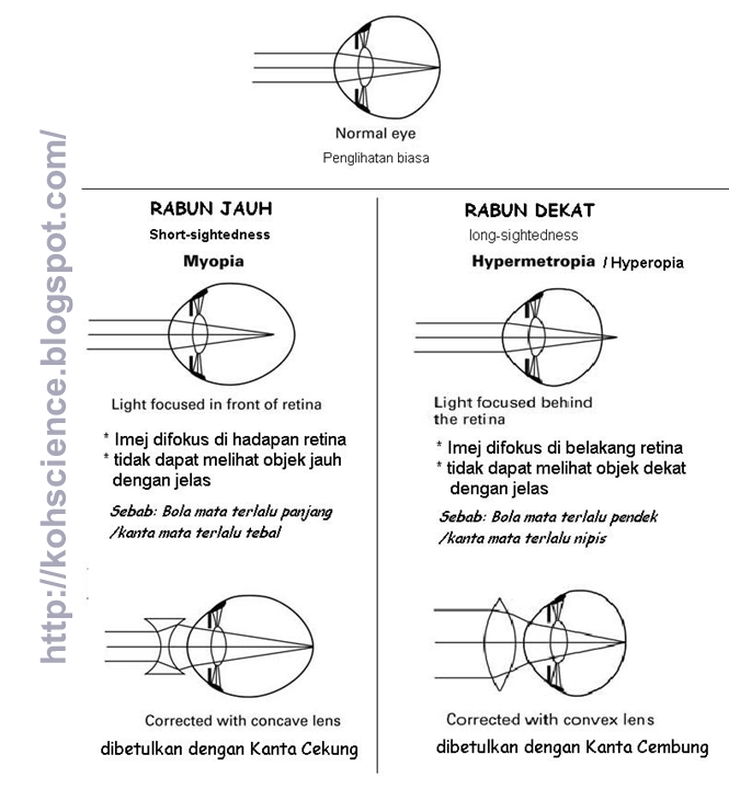 Explore to Koh's Science World ( Blog Sains): Rabun Dekat , Rabun Jauh