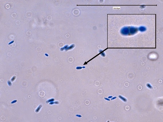 Fun With Microbiology (What's Buggin' You?): March 2014