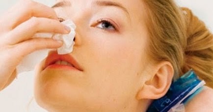 Anjuran Dan Cara Mengatasi Mimisan (Hidung Berdarah) Dengan Obat ...