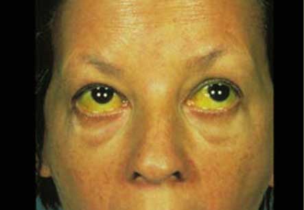 Men & Women Health Tips, Treatment, Lifesytle (Beauty Care) and Others ...