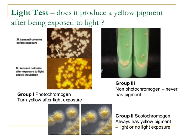 EXAMS AND ME : Photochromogens