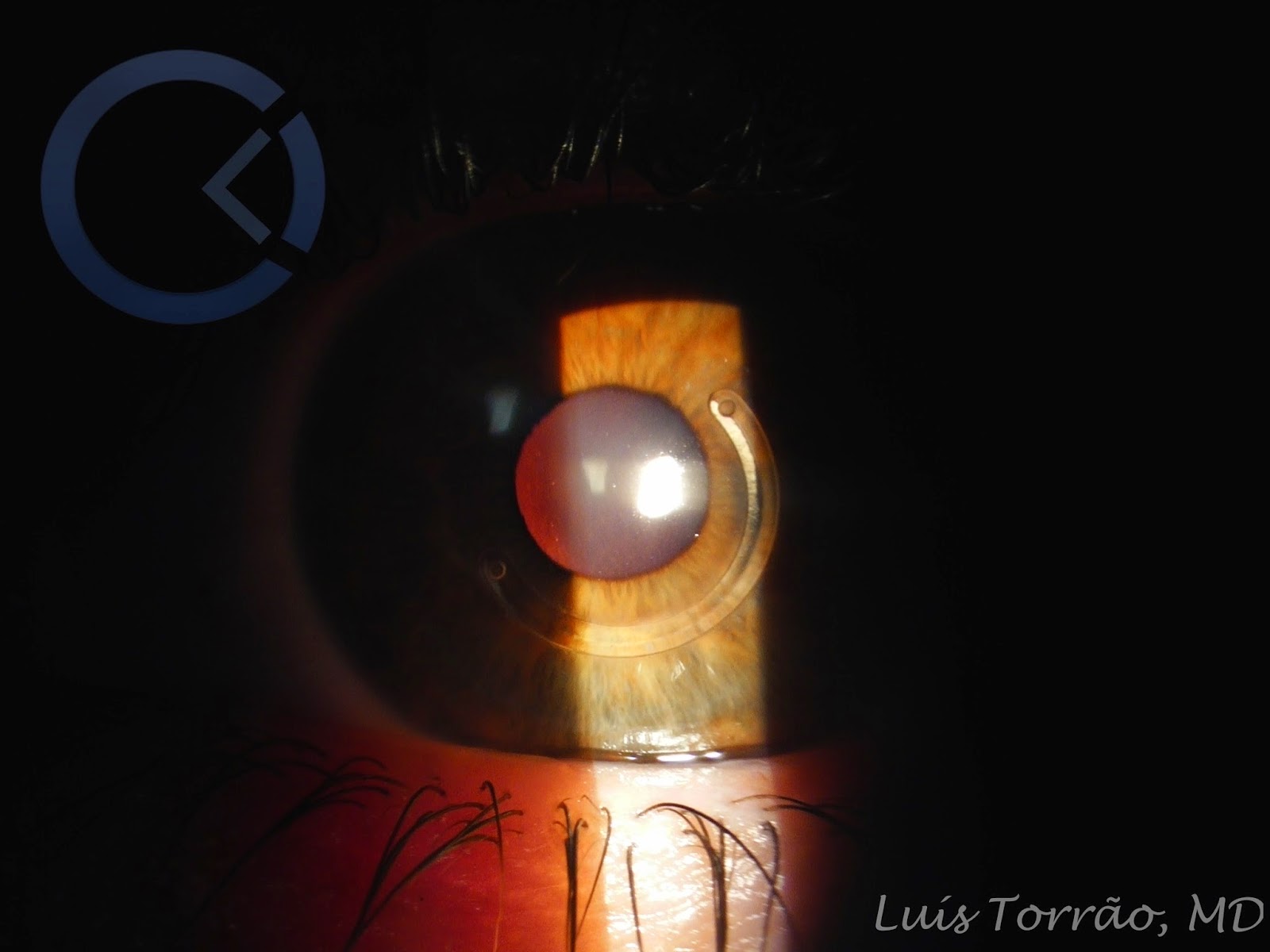 Eye Stuff: Ferrara Rings