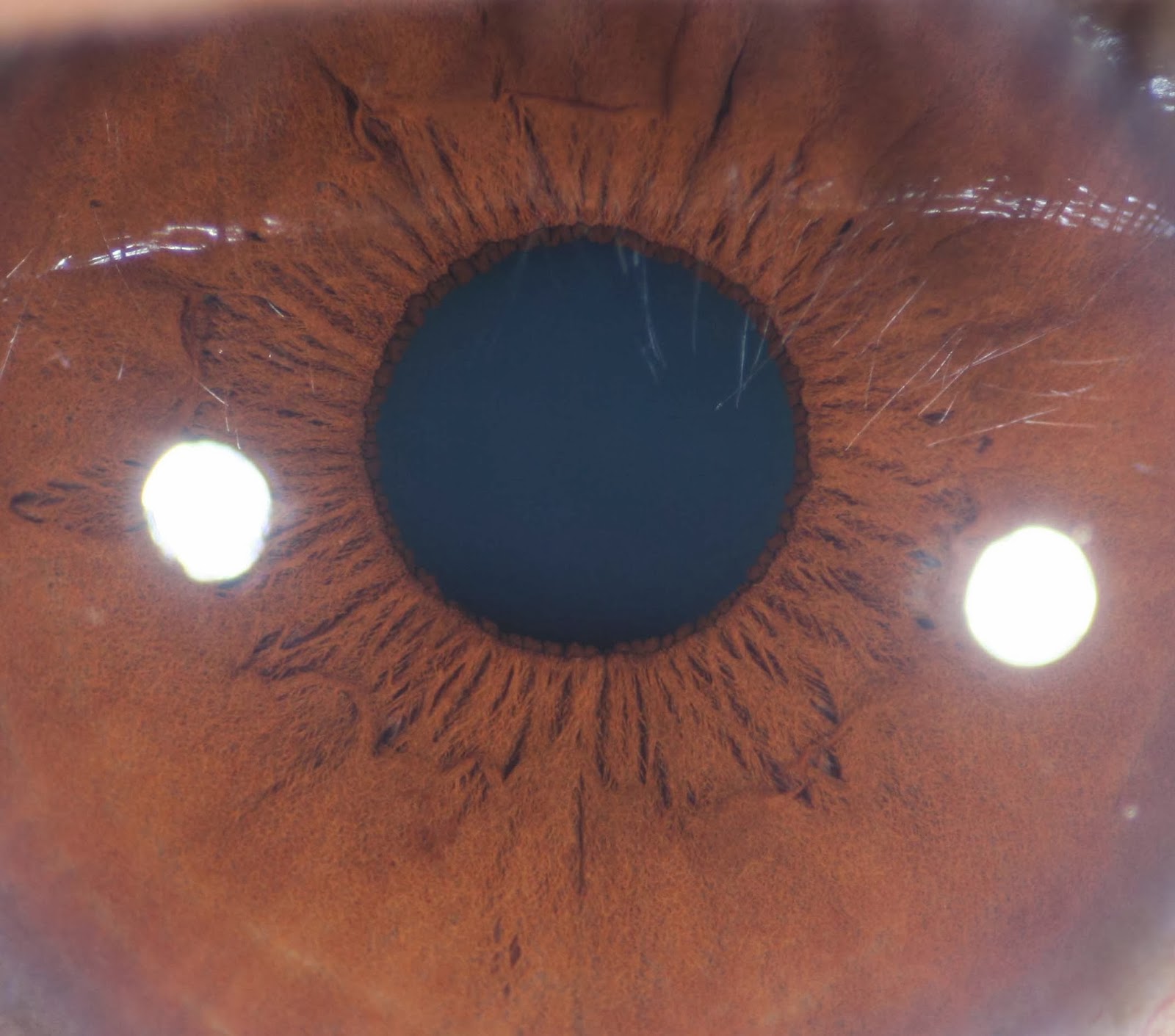 Modern & Multidimensional Iridology: IPB Morphologies, Pupil ...