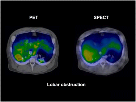 Instrumentación biomédica II (2016): abril 2016