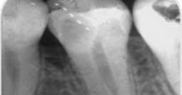 Desmodontite / monoarthrite ligamentaire ~ le carrefour des medecin ...