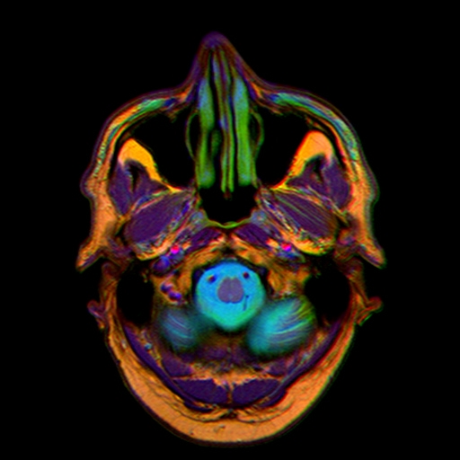 Nevit's blog: Color MRI of the Brain