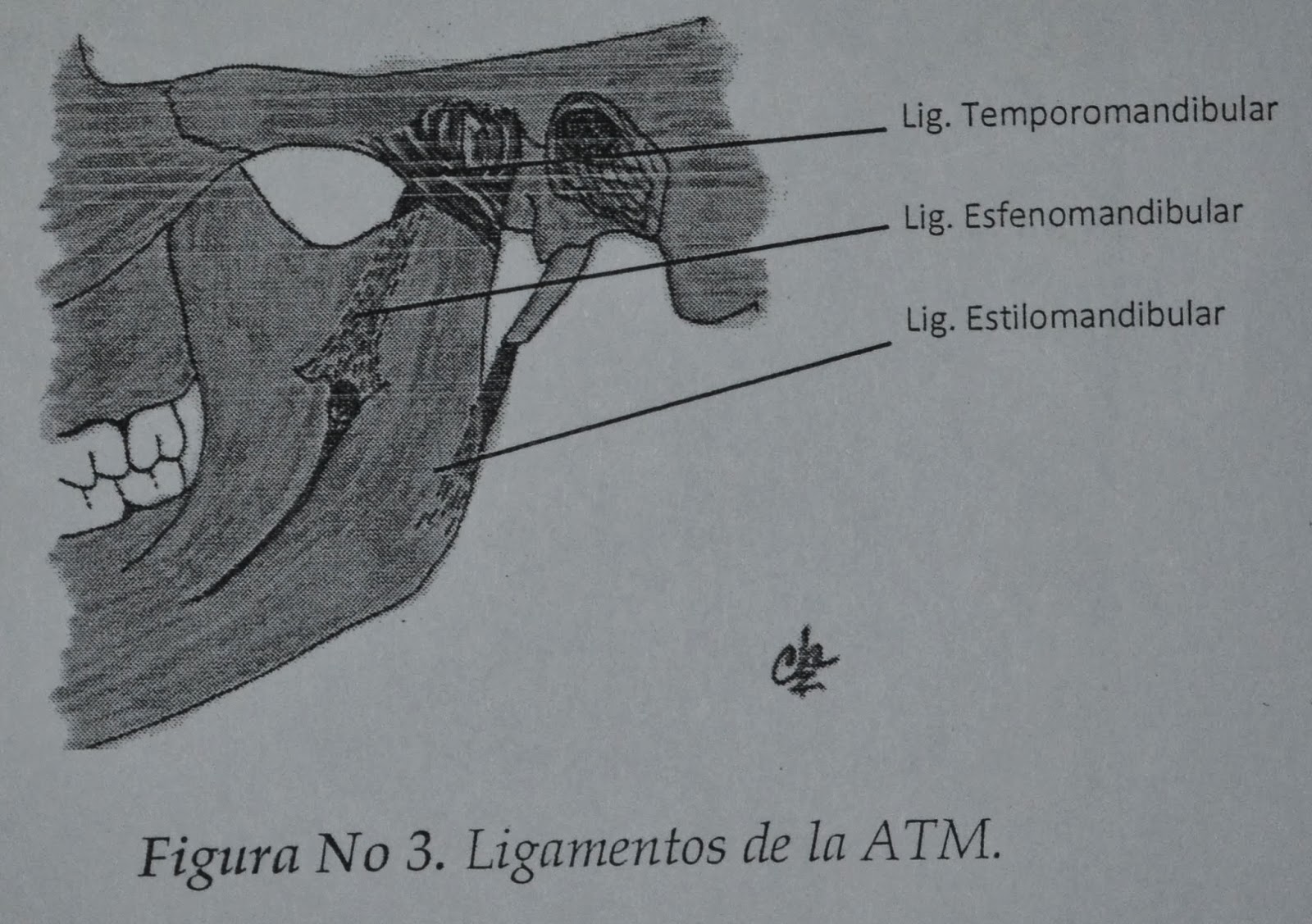 Orthodontics Team: ANATOMÍA CLÍNICA DE LA ARTICULACIÓN ...