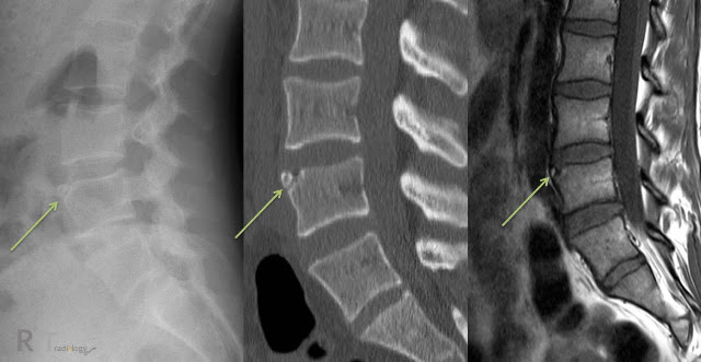 RiT radiology: January 2013