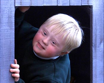 inkspired musings: Up syndrome and dreams