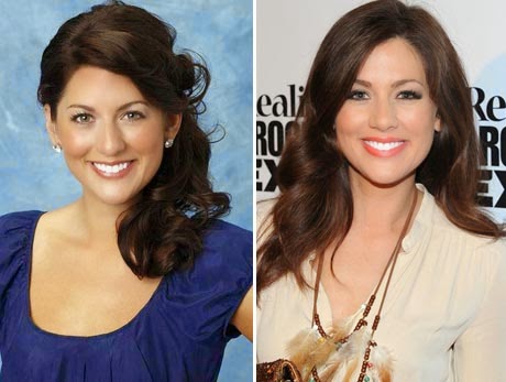 Jillian Harris Plastic Surgery