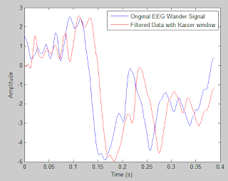 Biomedical Signal and Image Processing projects using Matlab and ...