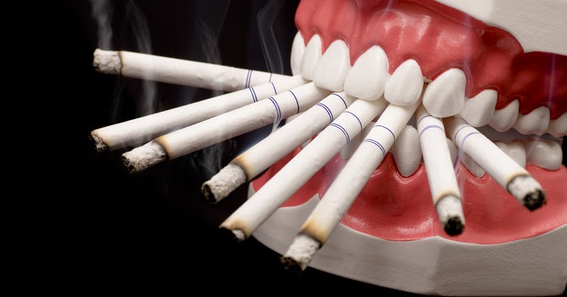 It's Ron: What do Cigarettes do to Your Teeth