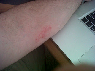 Talentd Mr Ripley: Rashful Reminder