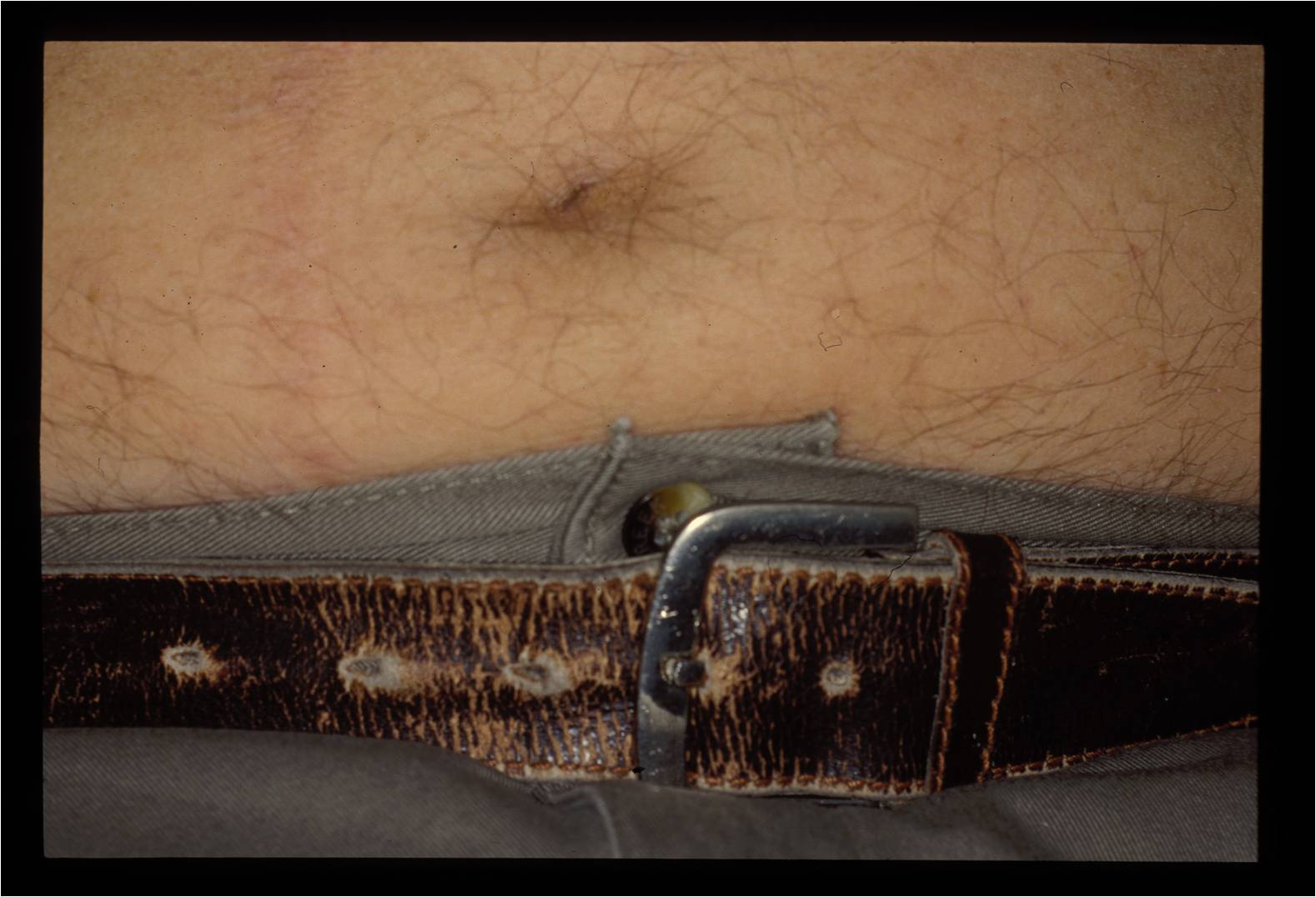 SIGNOS DE QUE ESTAS BARRIGON