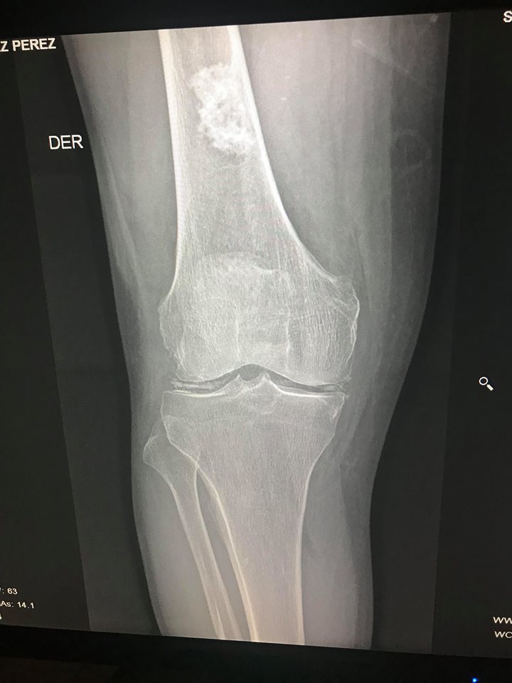 EL RINCÓN DE LA MEDICINA INTERNA. juanpedromacaluso@yahoo.com.ar ...