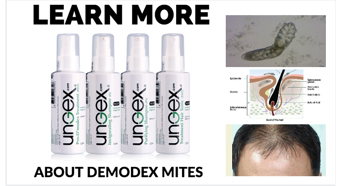 Blog | Demodex Treatment - Human Hair Follicle Mites: Demodex Mites ...