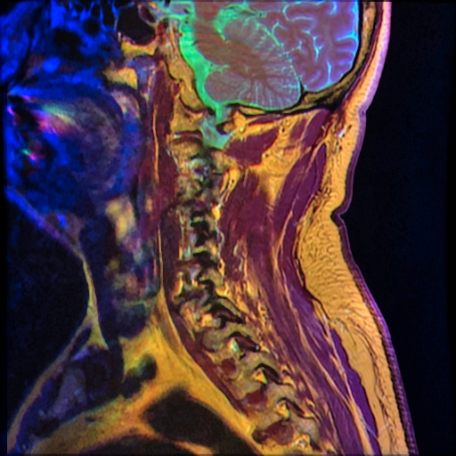 Nevit's blog: Color MRI of the Cervical verterbrae