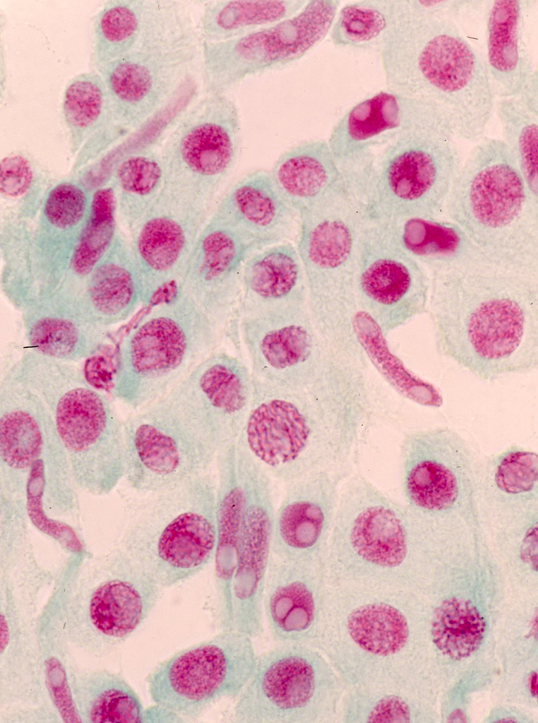 Laboratorio de Biología: MITOSIS EN MERISTEMAS VEGETAL
