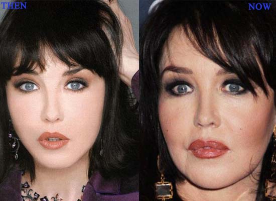 Isabelle Adjani Plastic Surgery Before and After Botox, Nose Job and ...