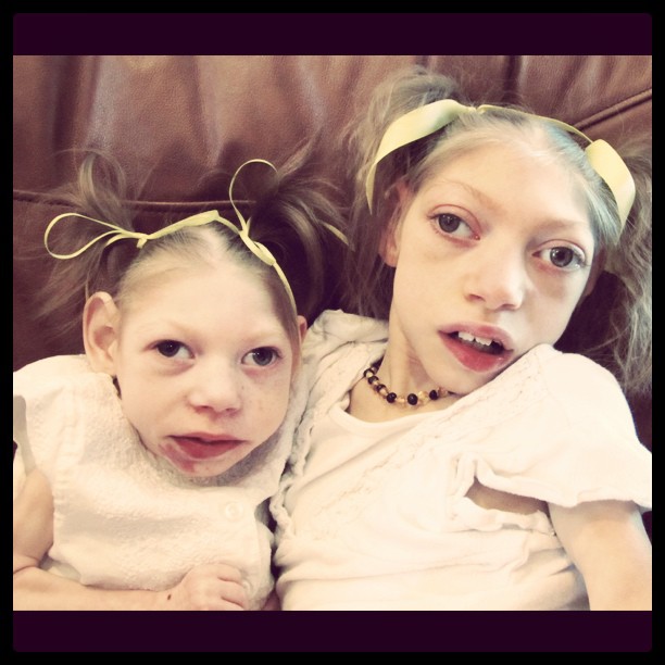 The Hartley Hooligans: Yellow