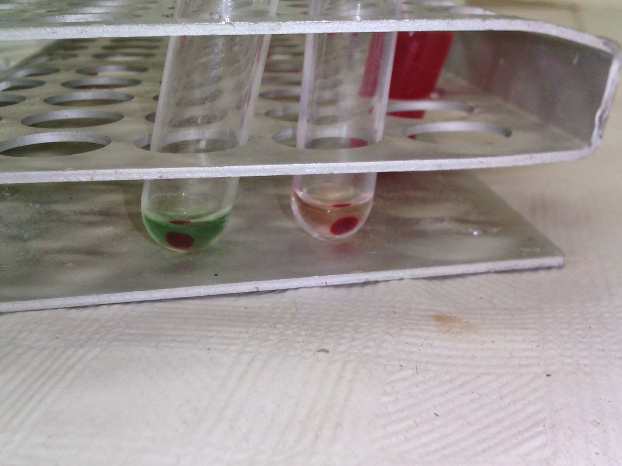 Cuaderno de practicas de hematología.: TEST DE COOMBS DIRECTO.