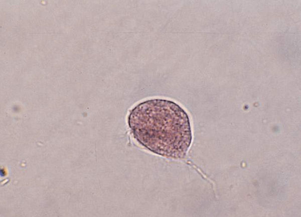 Medical Laboratory and Biomedical Science: Trichomonas vaginalis ...