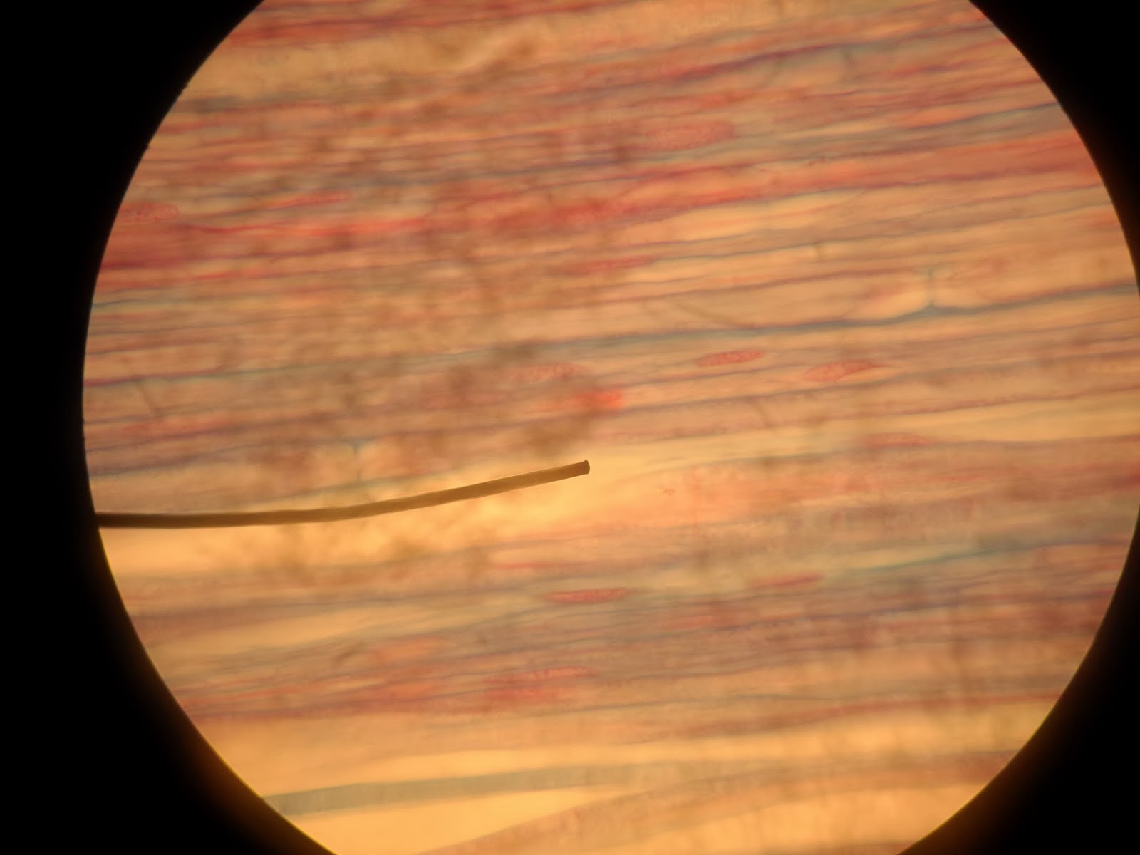 Ourlad's Paradigm: Nervous Tissue