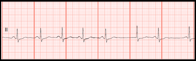 Various Escape Beats