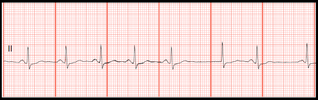 Various Escape Beats