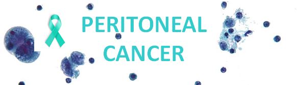 Peritoneal Cancer : Symptoms, Diagnosis, Treatment | Lari White ...