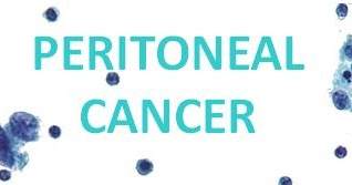 Peritoneal Cancer : Symptoms, Diagnosis, Treatment | Lari White ...