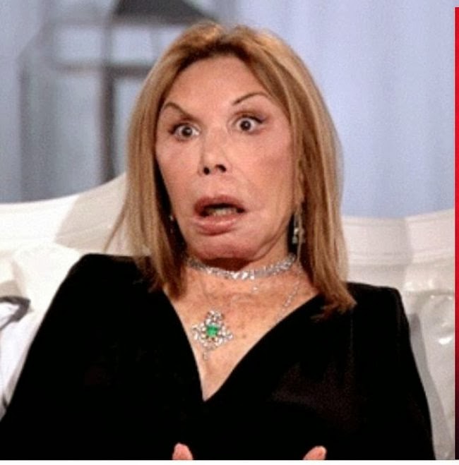 World Of Technology: Elsa Patton:The Worst Example Of Plastic Surgery ...