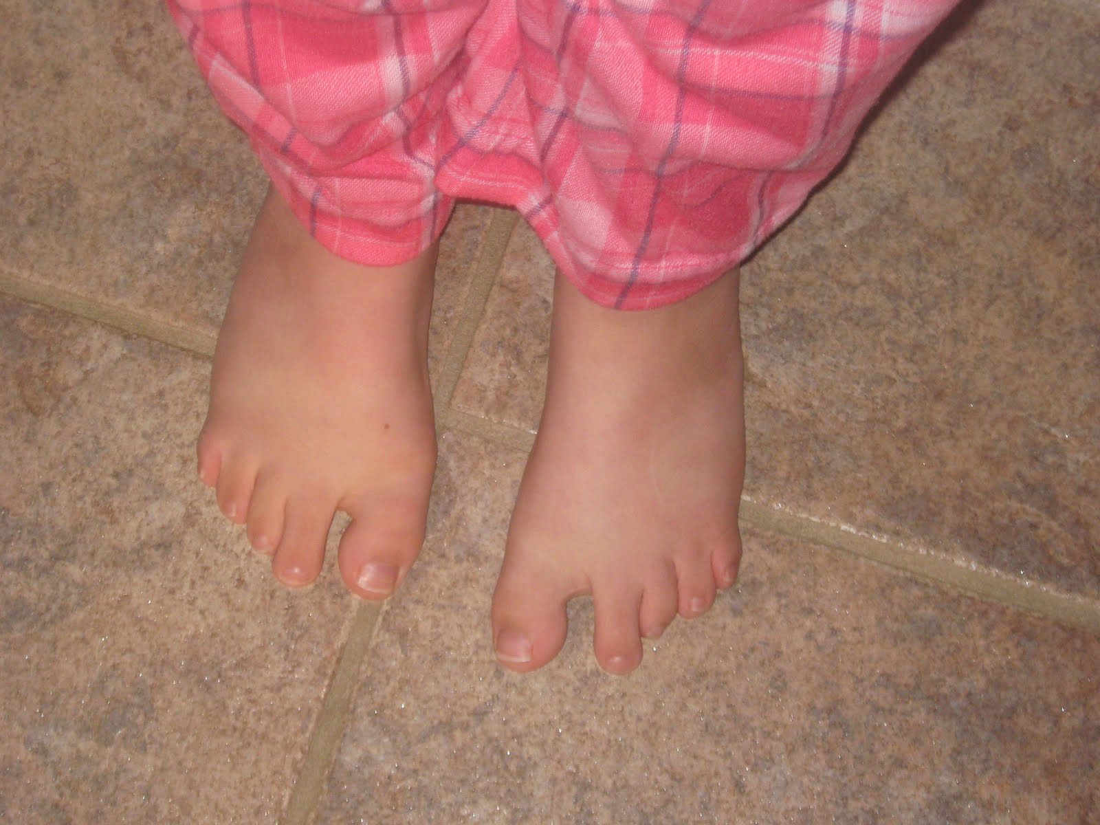 Beauty for Ashes: 30 Toes.....