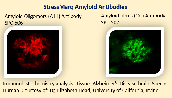 Newmarket Scientific: Short Article on Alzheimer’s Disease: #1 Amyloid ...