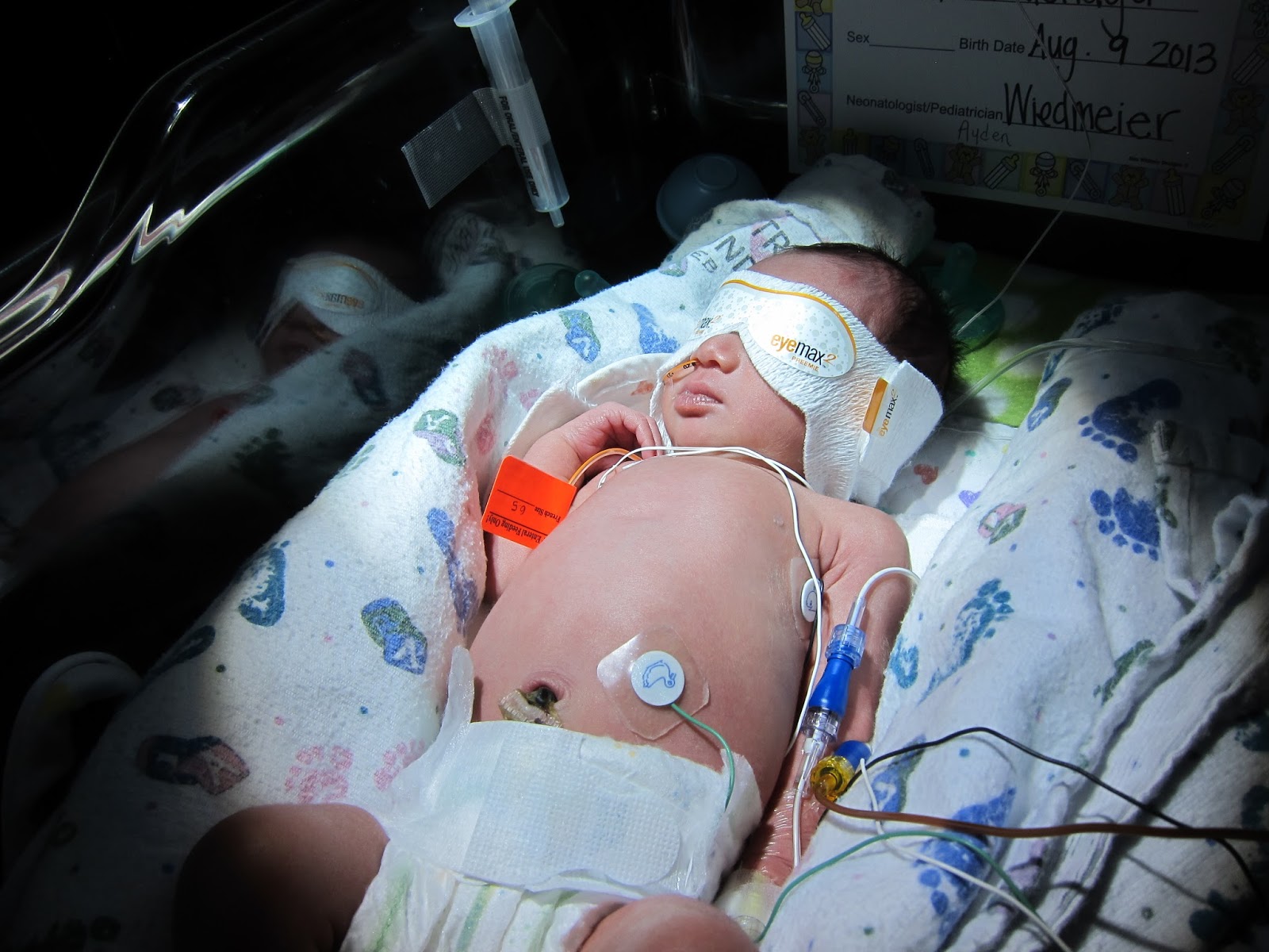 Our Baby Website: 32 Weeks - Baby Ayden's Birth Story