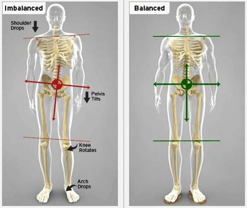 Fisioterapia para todos: DESBALANCE POSTURAL