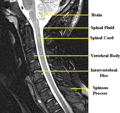 Garden of Eagan: MRI pictures