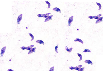TOXOPLASMA GONDII: toxogondii.blogspot.com