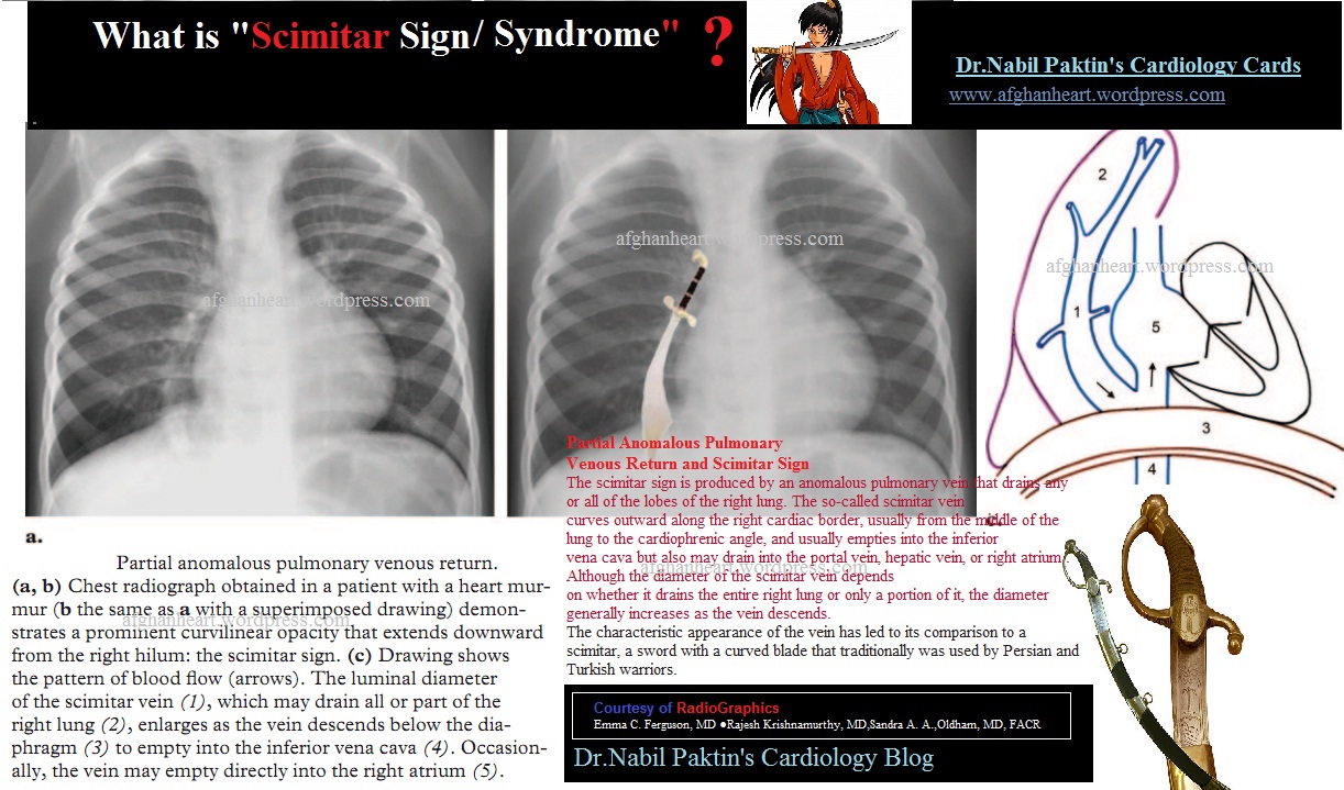 Dr.Nabil Paktin's Journal of Cardiovascular Medicine Blog ژورنال ( قلب ...