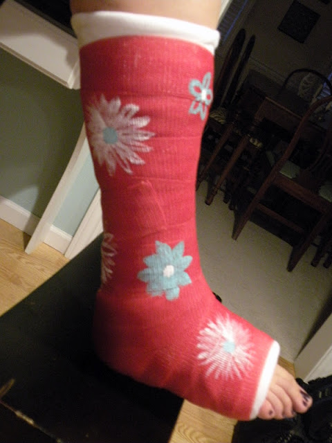 coffee and cocoa tea: How to Paint a Cast