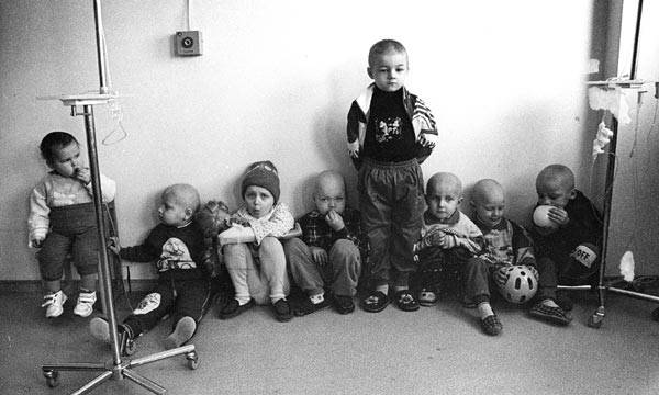 Deformutilation: Chernobyl victims