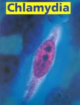 salud y humanidad: Clamidia: ¿Qué conoces de esta enfermedad?