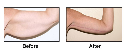 All Cosmetic Options : Your Guide to all cosmetic and beauty treatments ...