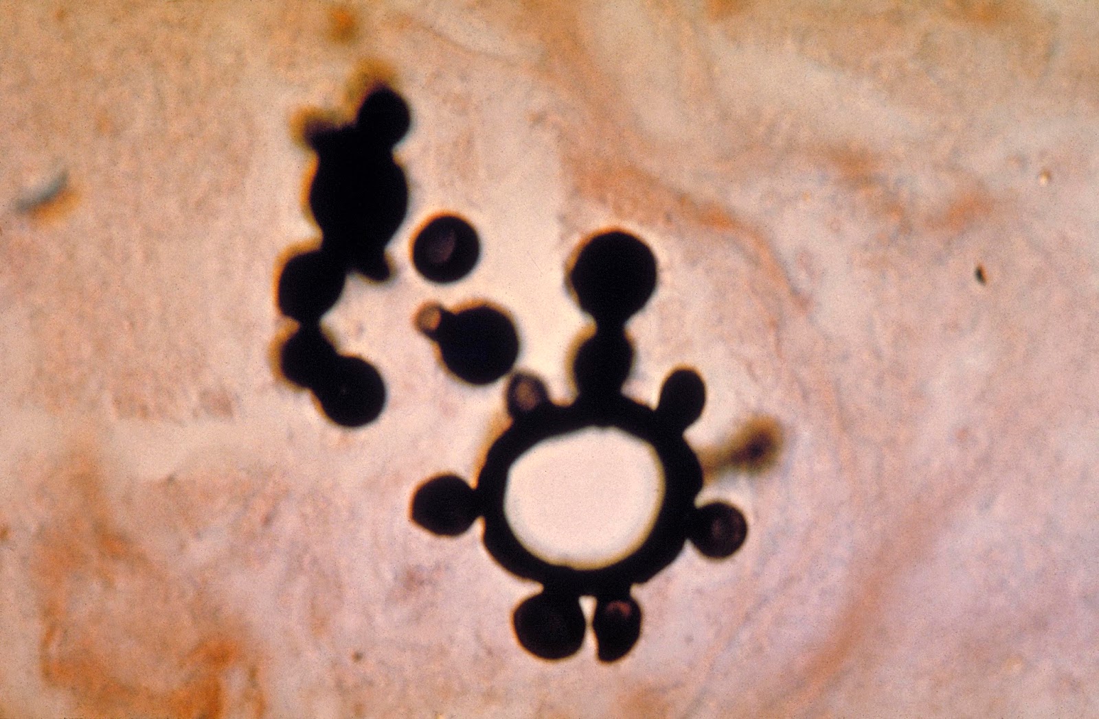 Lecture Notes in Medical Technology: Lecture #16: INTRODUCTION TO MYCOLOGY