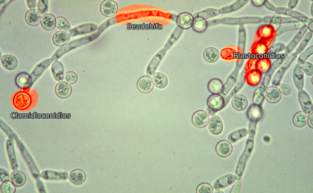 el Hallazgo: Tipos de cándida