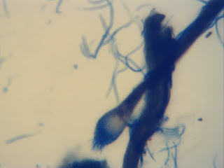 Trabajos de investigacion: HONGO MONILIAL: GRAPHIUM sp.