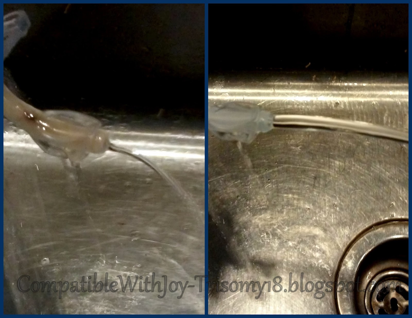 Compatible With Joy-Trisomy18: 04/01/2016 - 05/01/2016